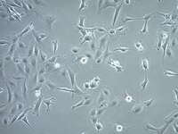 12Z Human Endometrial Epithelial Cell Line | SCC443